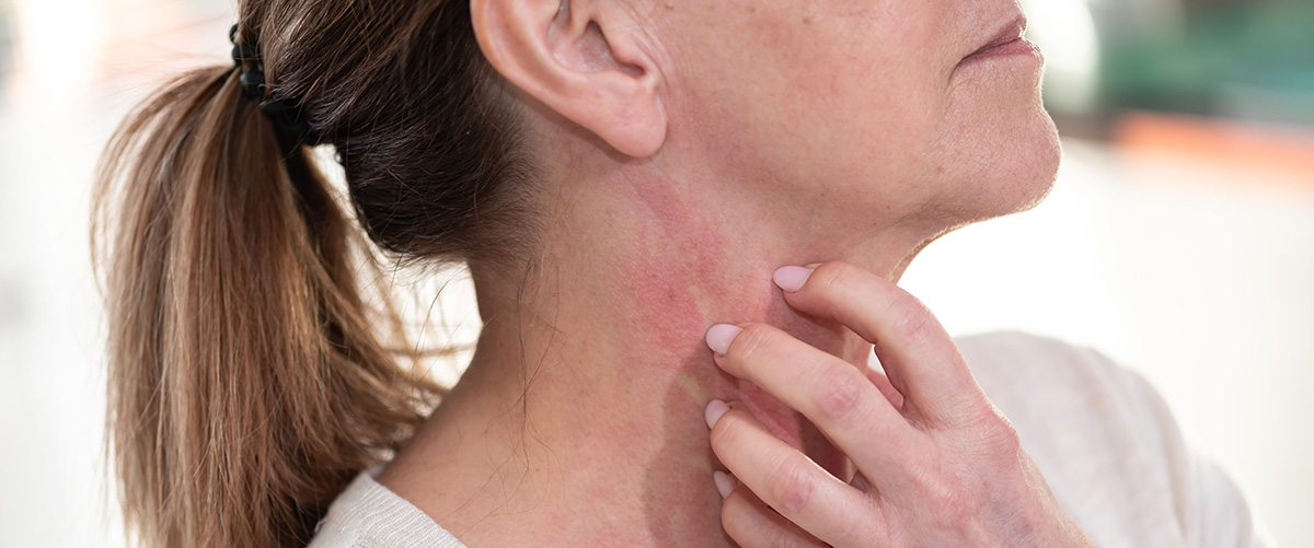 Hoe verzorg ik een droge huid?